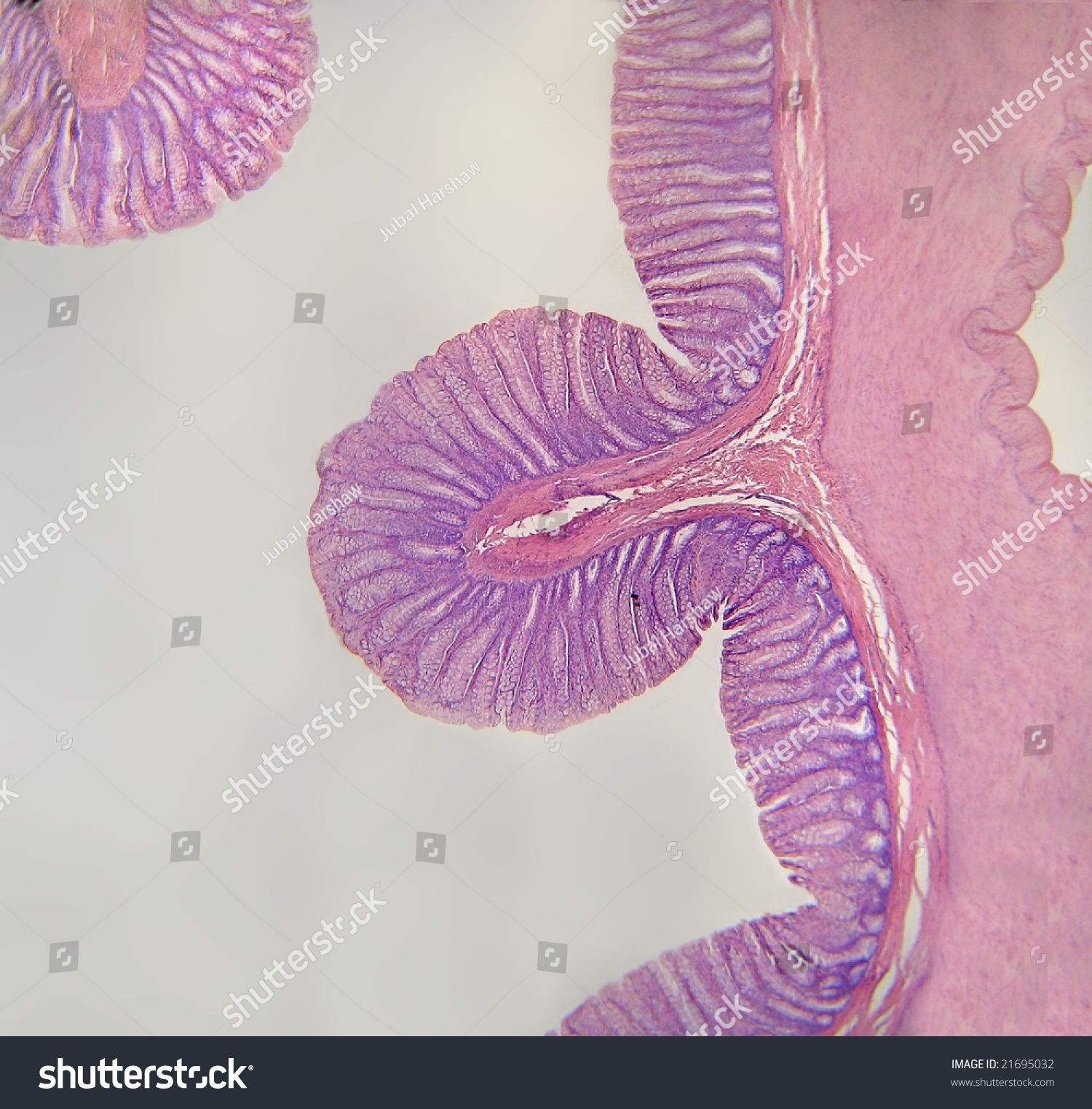Microscopic Cross Section Of The Wall Of The Large Intestine Stock