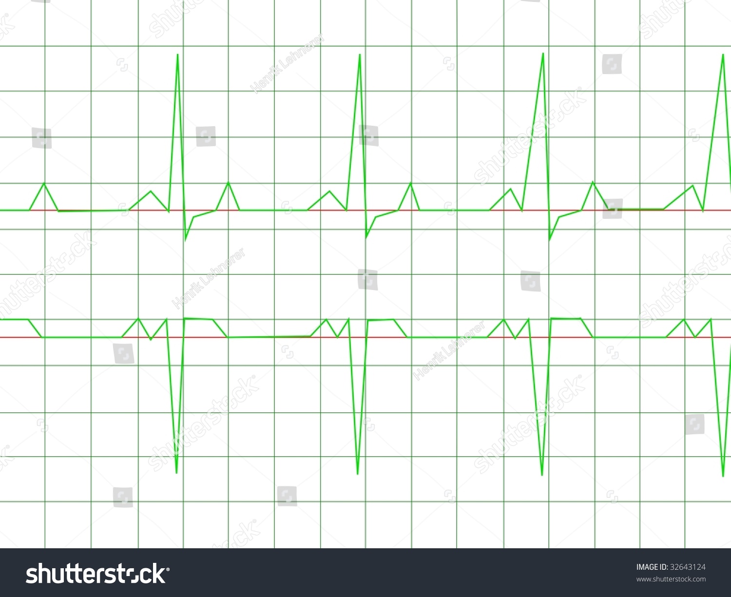 Normal Heart Rhythm Electrocardiogram Ecg Graph Stock Illustration ... Normal Heart Rhythm Electrocardiogram Ecg Graph Stock Illustration ...