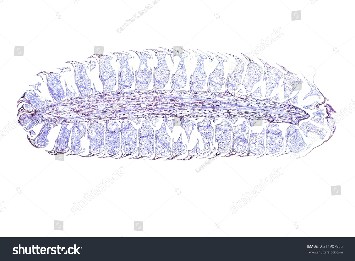 Pinus Staminate Male Pine Cone Microscope Slide Longitudinal Section Shows Where Pollen Is