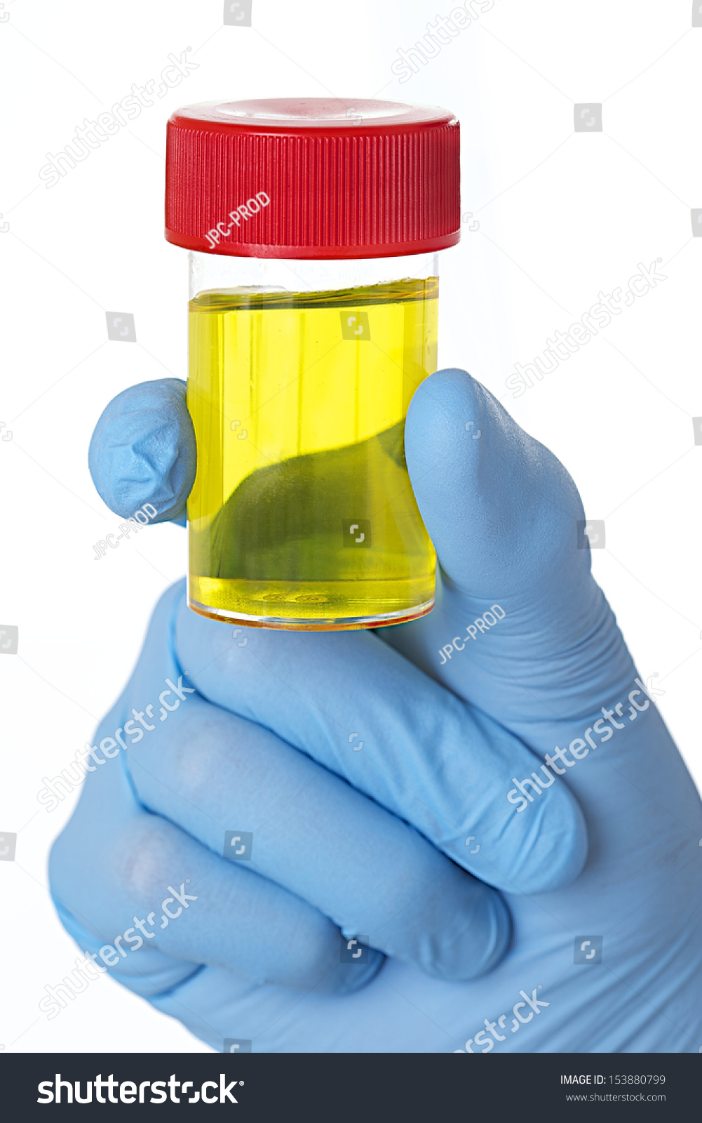 Urine Specimen - Medical Analysis Stock Photo 153880799 : Shutterstock Urine Specimen - Medical Analysis Stock Photo 153880799 : Shutterstock