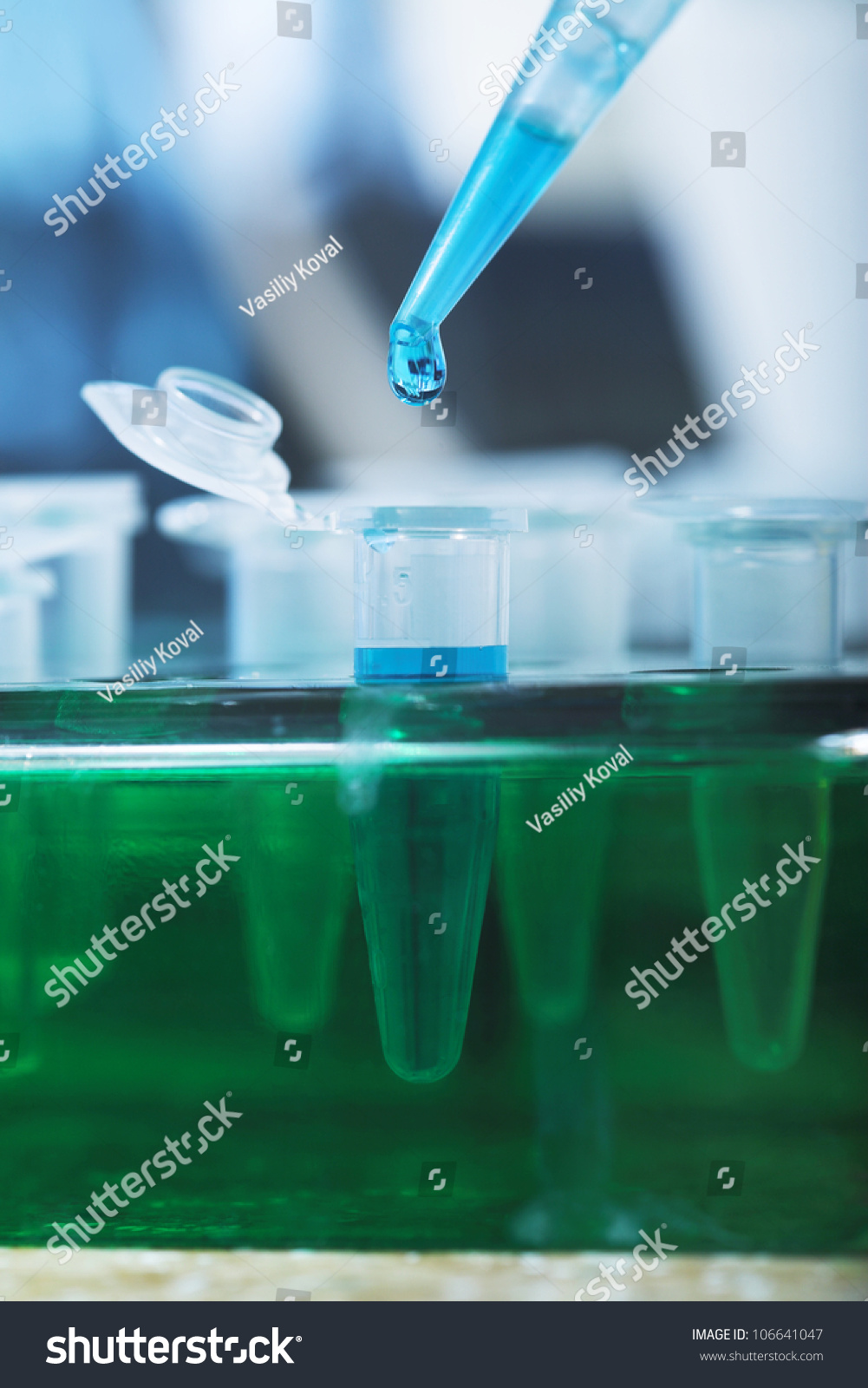 Molecular Biology Laboratory Tests at Lindsay Mullen blog Molecular Biology Laboratory Tests at Lindsay Mullen blog