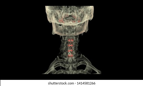 3d Computed Tomography Ct Cervical Spine Stock Illustration 1414581266 ...