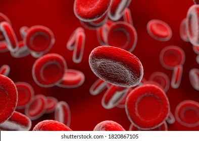 Blood Clot Calcified Lesion Plaque Artery Stock Illustration 93504403