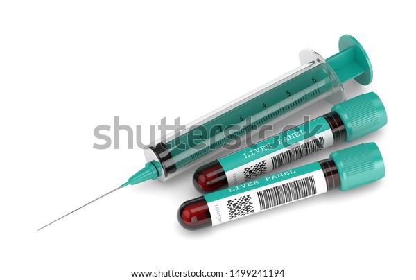 3d Render Liver Panel Blood Tubes Stock Illustration 1499241194 ...
