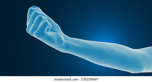 Dermatographic Urticaria Known Dermographism Dermatographism Skin Stock ...