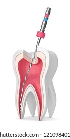 702 Endodontic file Images, Stock Photos & Vectors | Shutterstock