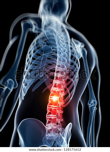 3d Rendered Illustration Backache Stock Illustration 128575652