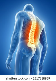 5,715 3d man back pain Images, Stock Photos & Vectors | Shutterstock