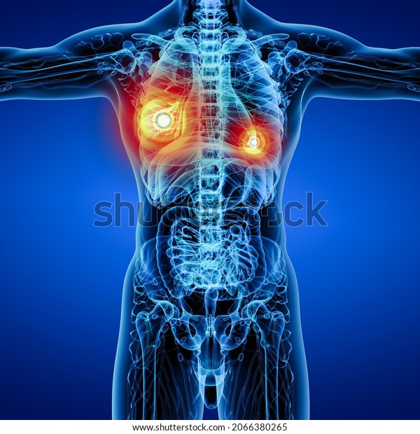 3d Rendering Blue Lymphatic System Front Stock Illustration 2066380265 ...