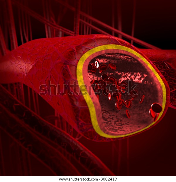 3d Rendering Cut Section Blood Arteries Stock Illustration 3002419