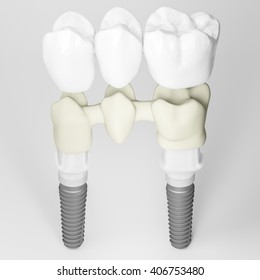35,610 Construction teeth Images, Stock Photos & Vectors | Shutterstock