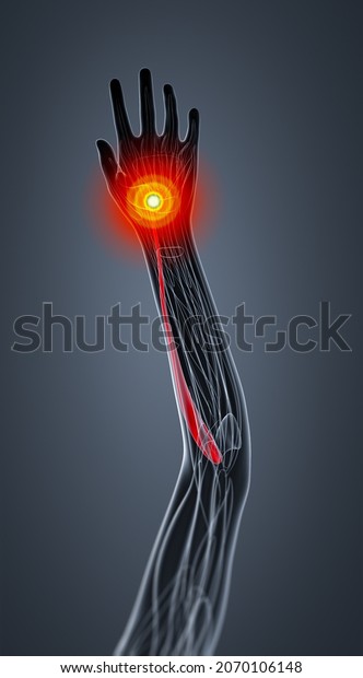 3d Rendering Medical Illustration Extensor Carpi Stock Illustration ...