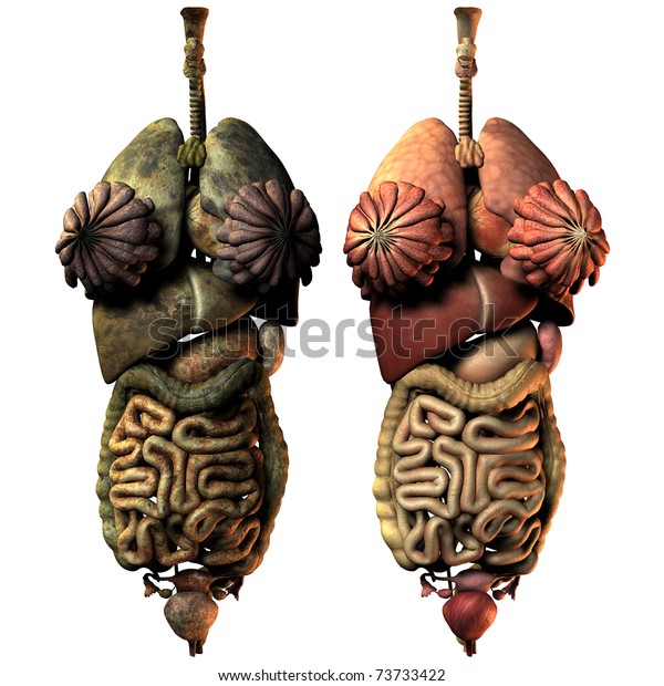 3d Rendering Sick Healthy Internal Organs 스톡 일러스트 73733422 | Shutterstock