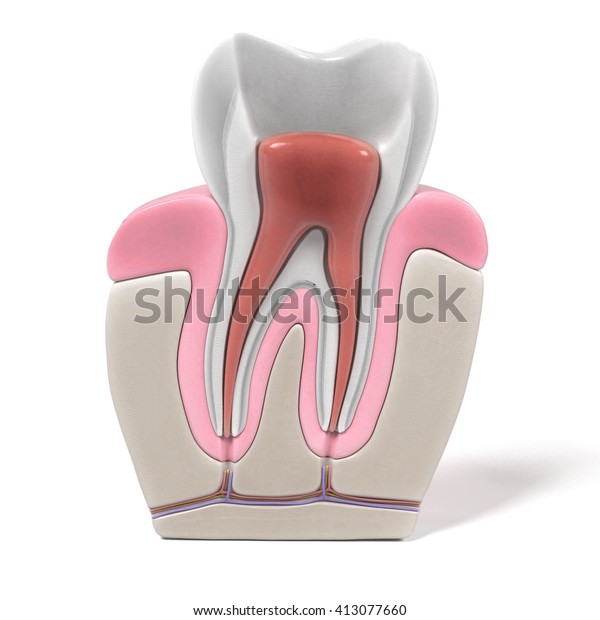 3d Renderings Endodontics Root Canal Procedure Stock Illustration 413077660