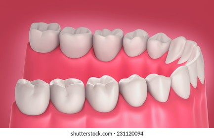 50,788 Side teeth Images, Stock Photos & Vectors | Shutterstock