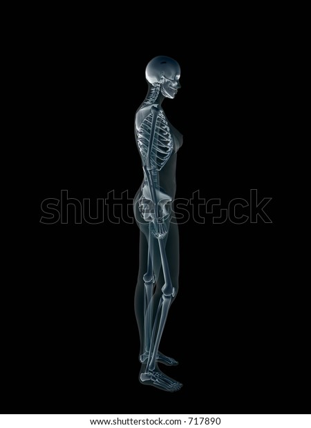 Anatomically Correct Xray Xray Human Female Stock Illustration 717890