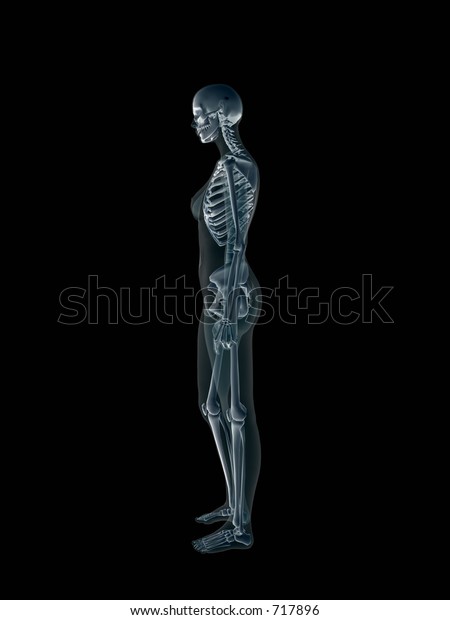 「Anatomically Correct Xray Xray Human Female」のイラスト素材 717896