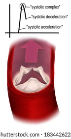 Aortic Regurgitation Flow Waveform According Duplex: ilustrações stock ...