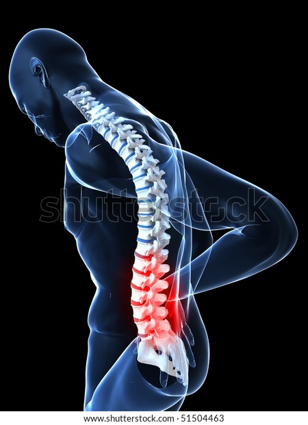 Backache Stock Illustration 51504463