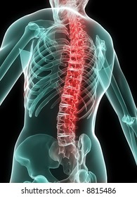 Backache Illustration Stock Illustration 8815486 | Shutterstock