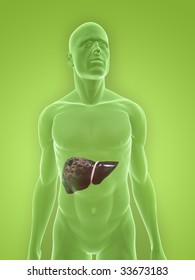 1,090 Bad Liver Images, Stock Photos & Vectors | Shutterstock
