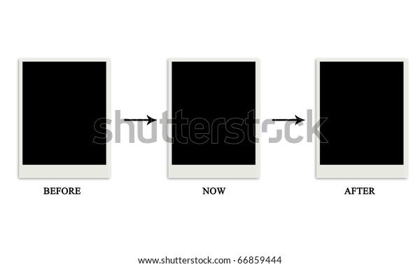 Before Now After Frame Image Stock Illustration 66859444 | Shutterstock