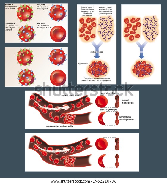 Blood Circulation Cells Blood Different Types Stock Illustration ...