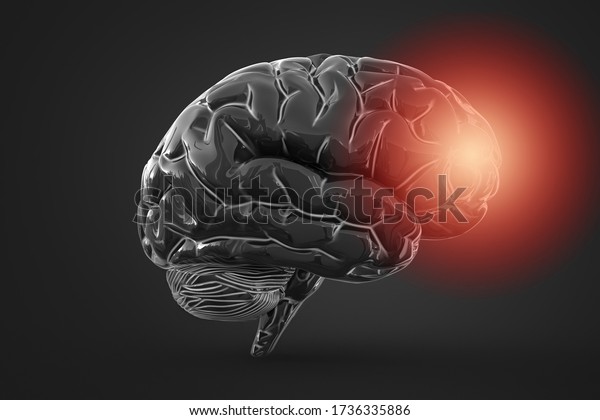 Brain Inflammation Other Process Associated Tissues Stock Illustration ...
