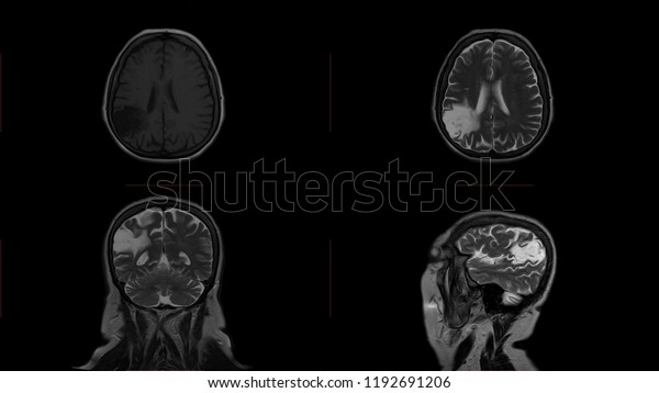 Brain Mri Different Modes Planes Patient 스톡 일러스트 1192691206 | Shutterstock