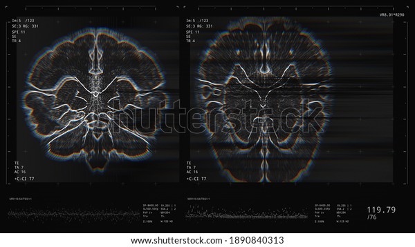 Brain Scan Screen Device Scans Displays: ilustrações stock 1890840313 ...