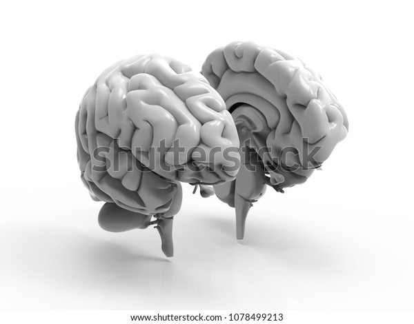 Brain Surgery 3d Render Stock Illustration 1078499213