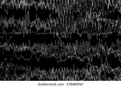 Brain Wave On Eeg Background Electroencephalogram Stock Illustration ...