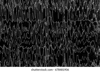 Brain Wave On Eeg Background Electroencephalogram Stock Illustration ...