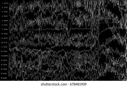 Brain Wave On Eeg Background Electroencephalogram Stock Illustration ...