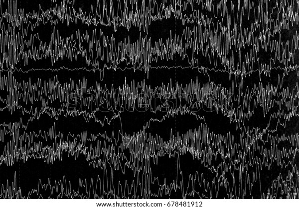 Brain Wave On Eeg Background Electroencephalogram Stock Illustration ...