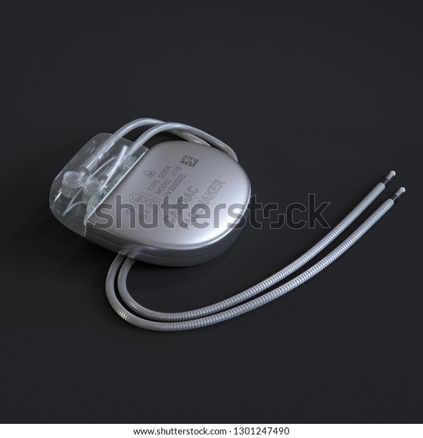 Cardiac Pacemaker 3d Model 3d Illustration Stock Illustration 1301247490