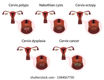 Ectopies Images, Stock Photos & Vectors | Shutterstock