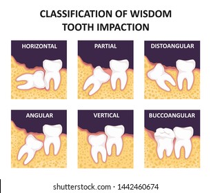166 Angular jaw Images, Stock Photos & Vectors | Shutterstock