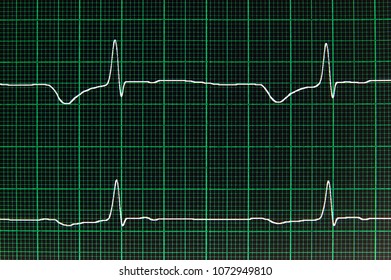 Closeup Ecg Graph Record Stock Illustration 1072949810 | Shutterstock
