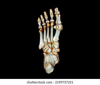 10,346 3d foot skeleton Images, Stock Photos & Vectors | Shutterstock
