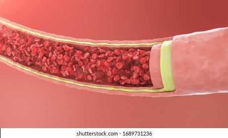 Cross Section Artery View Red Blood Stock Illustration 1689731236 ...