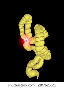 Ct Colonography Ct Colonography 3d Rendering Stock Illustration ...