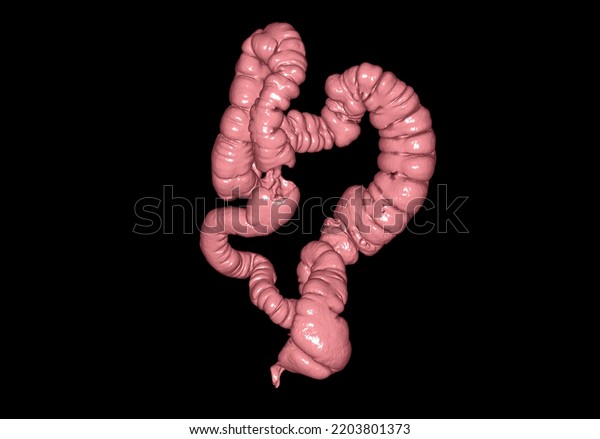 Ct Colonography Ct Colonography 3d Rendering Stock Illustration ...