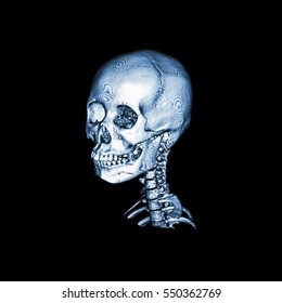Ct Scan 3d Image Normal Human 스톡 일러스트 550362769 | Shutterstock