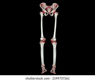 Ct Scan Lower Extremity 3d Diagnosis Stock Illustration 2199737261 ...