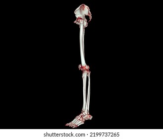 Ct Scan Lower Extremity 3d Diagnosis Stock Illustration 2199737265 ...