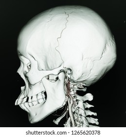 Ctscan Vs 3d Surface Scanning Skull Stock Illustration 1265620378 ...