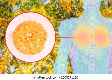 Development Allergic Reaction Pollen Human Body Stock Illustration ...