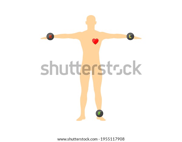 Einthoven Ecg Triangle Including Augmented Unipolar: ภาพประกอบสต็อก ... Einthoven Ecg Triangle Including Augmented Unipolar: ภาพประกอบสต็อก ...