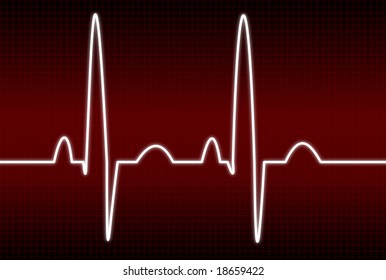 Ekg Stock Illustration 18659419 | Shutterstock